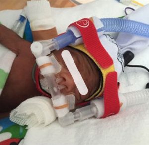 February 2023 Newsletter | Bubble CPAP Institute